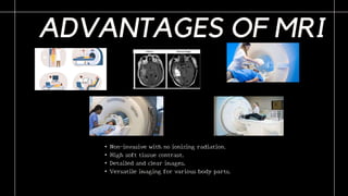"Understanding MRI Scans: How They Work – A Guide by Sanjivini ...