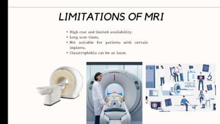 "Understanding MRI Scans: How They Work – A Guide by Sanjivini ...