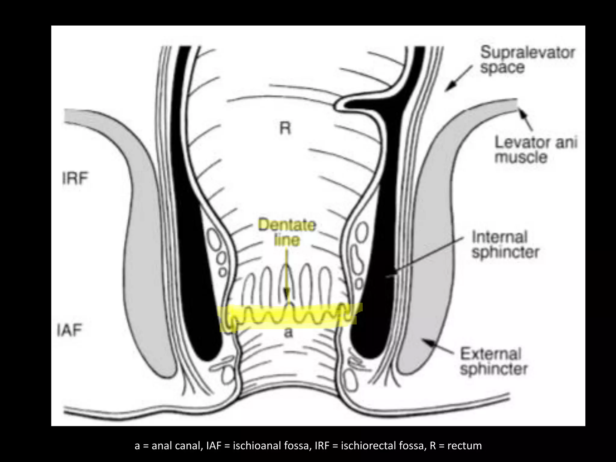 MRI fistulogram | PDF