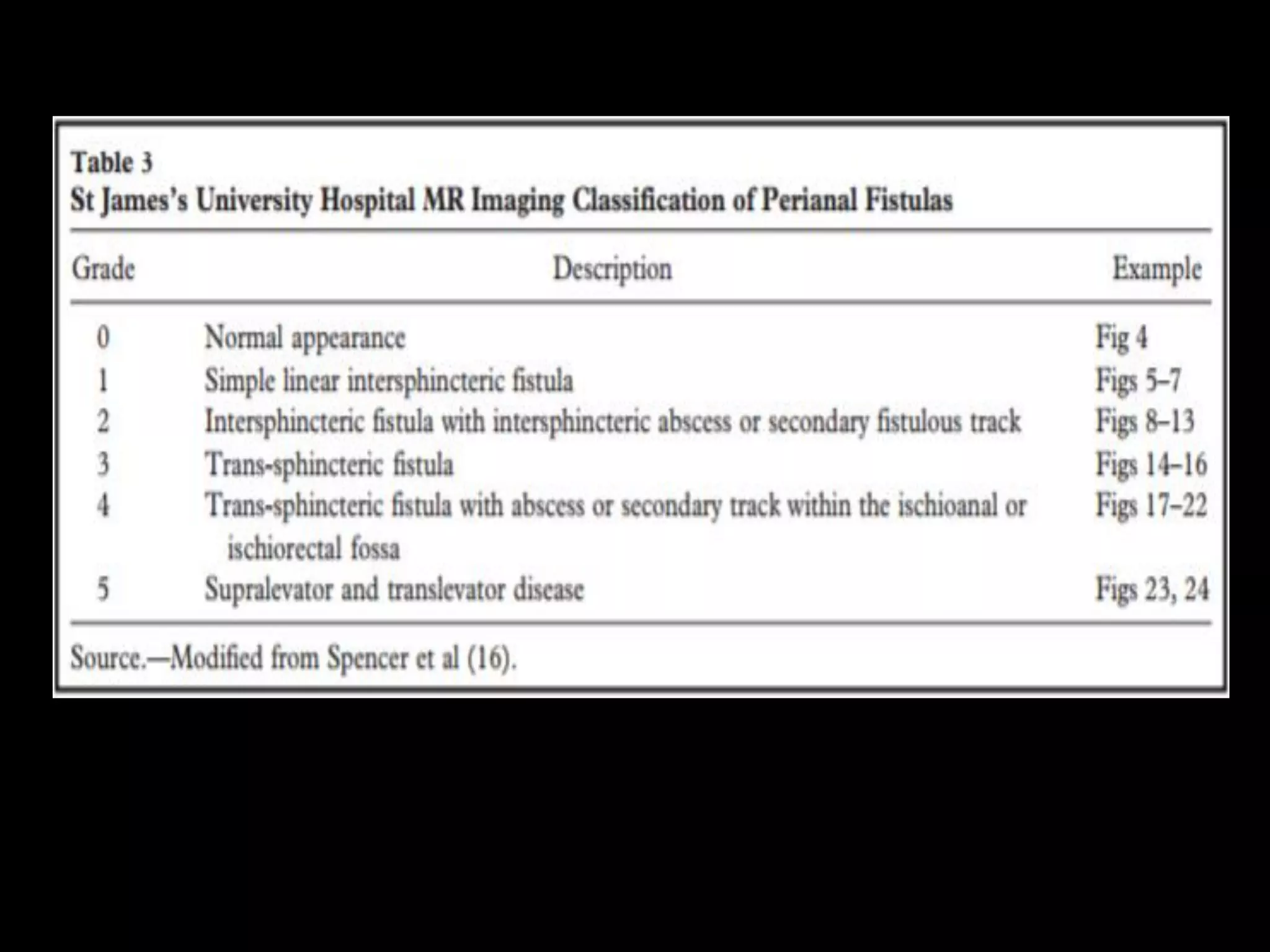 MRI fistulogram | PDF