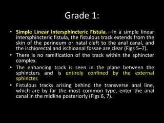 MRI fistulogram | PDF