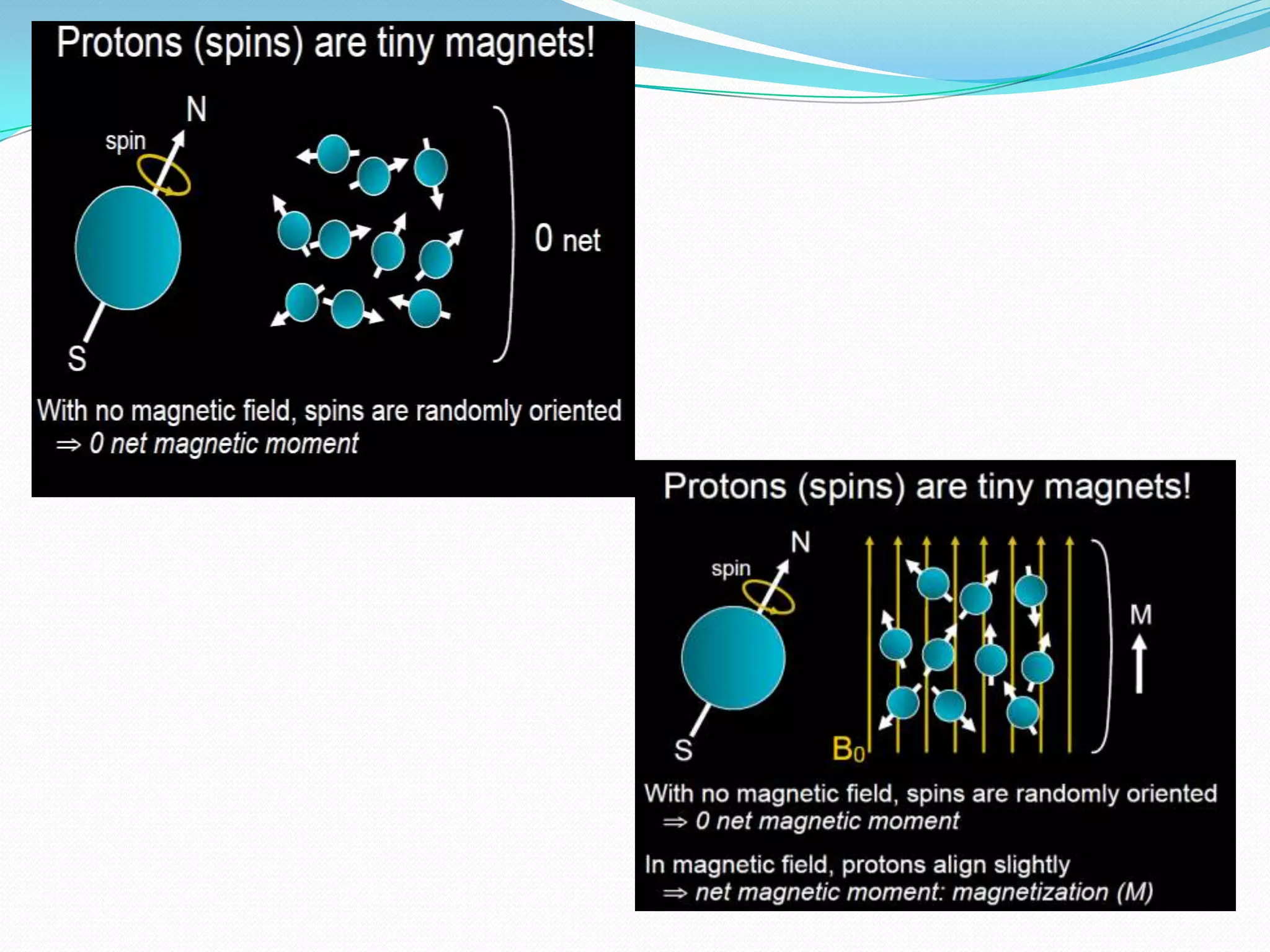 Mri for identifying types of fistulae | PPTX