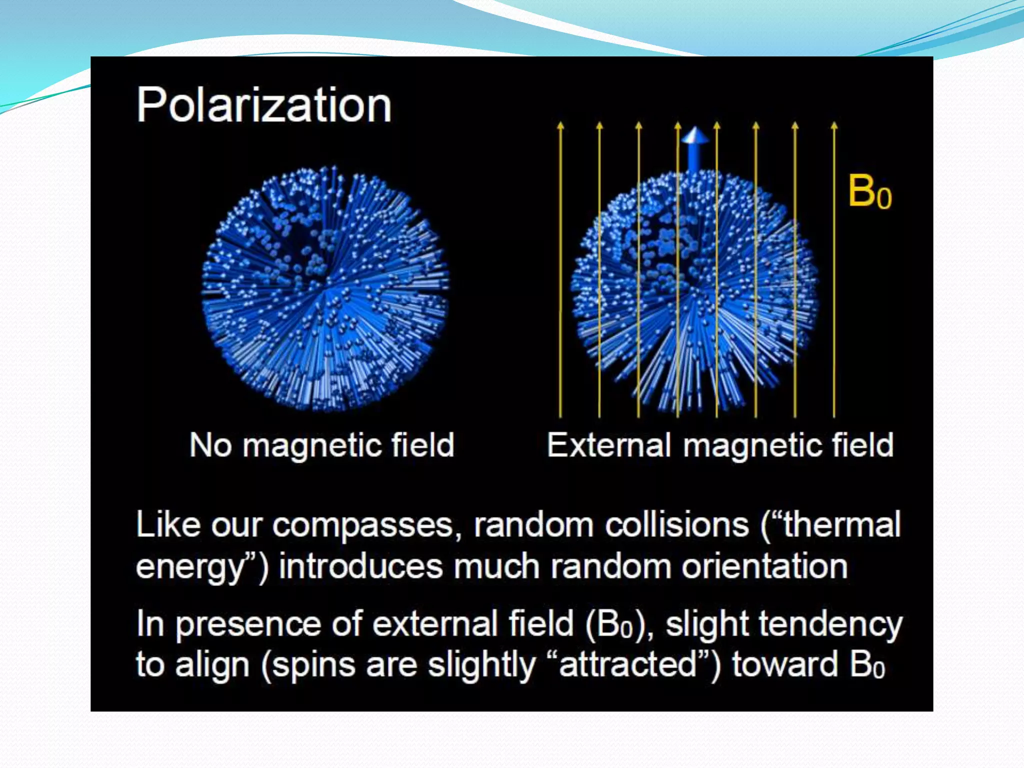 Mri for identifying types of fistulae | PPTX