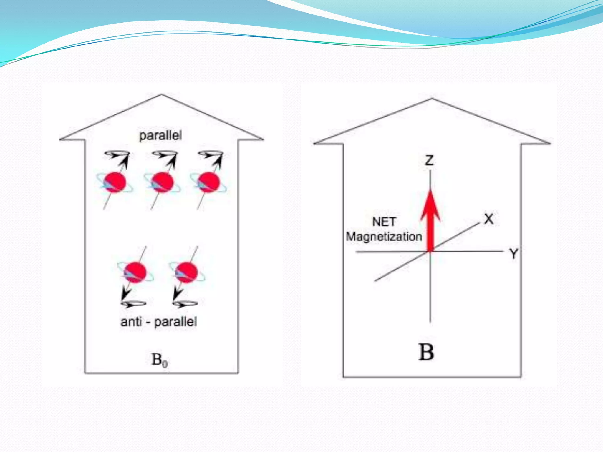 Mri for identifying types of fistulae | PPTX