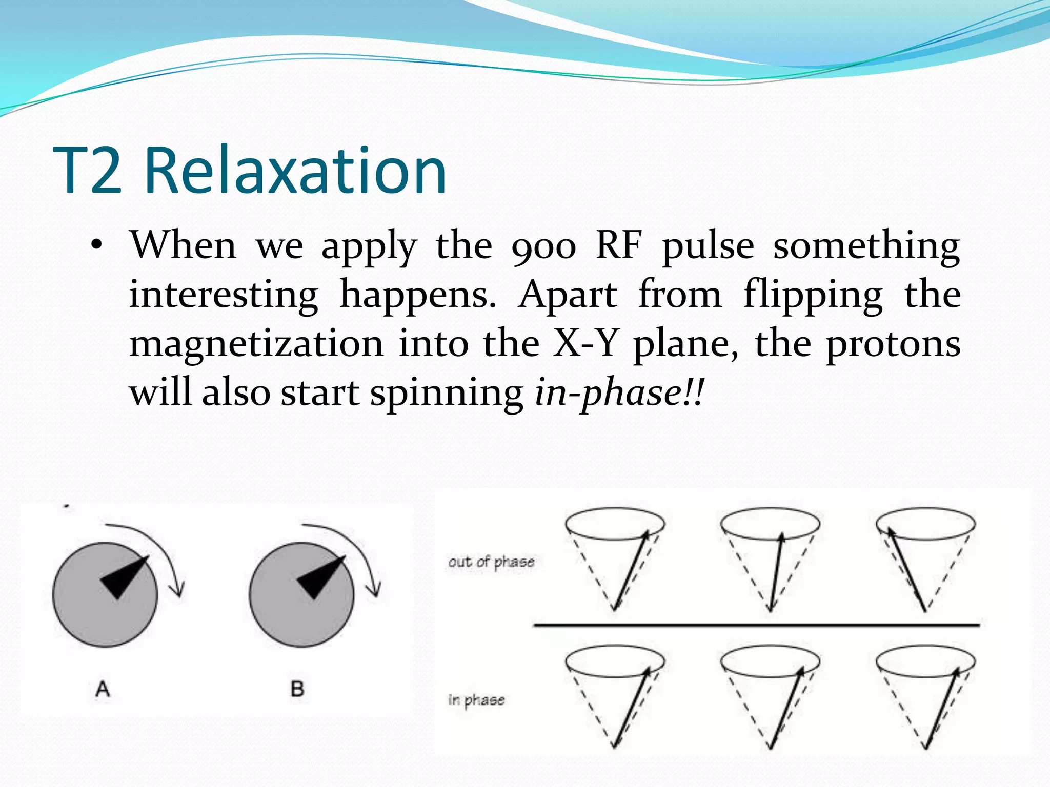 Mri for identifying types of fistulae | PPTX