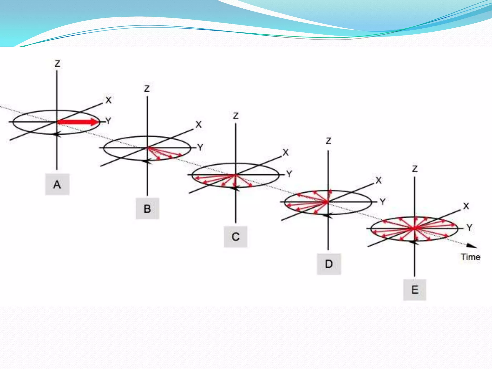 Mri for identifying types of fistulae | PPTX