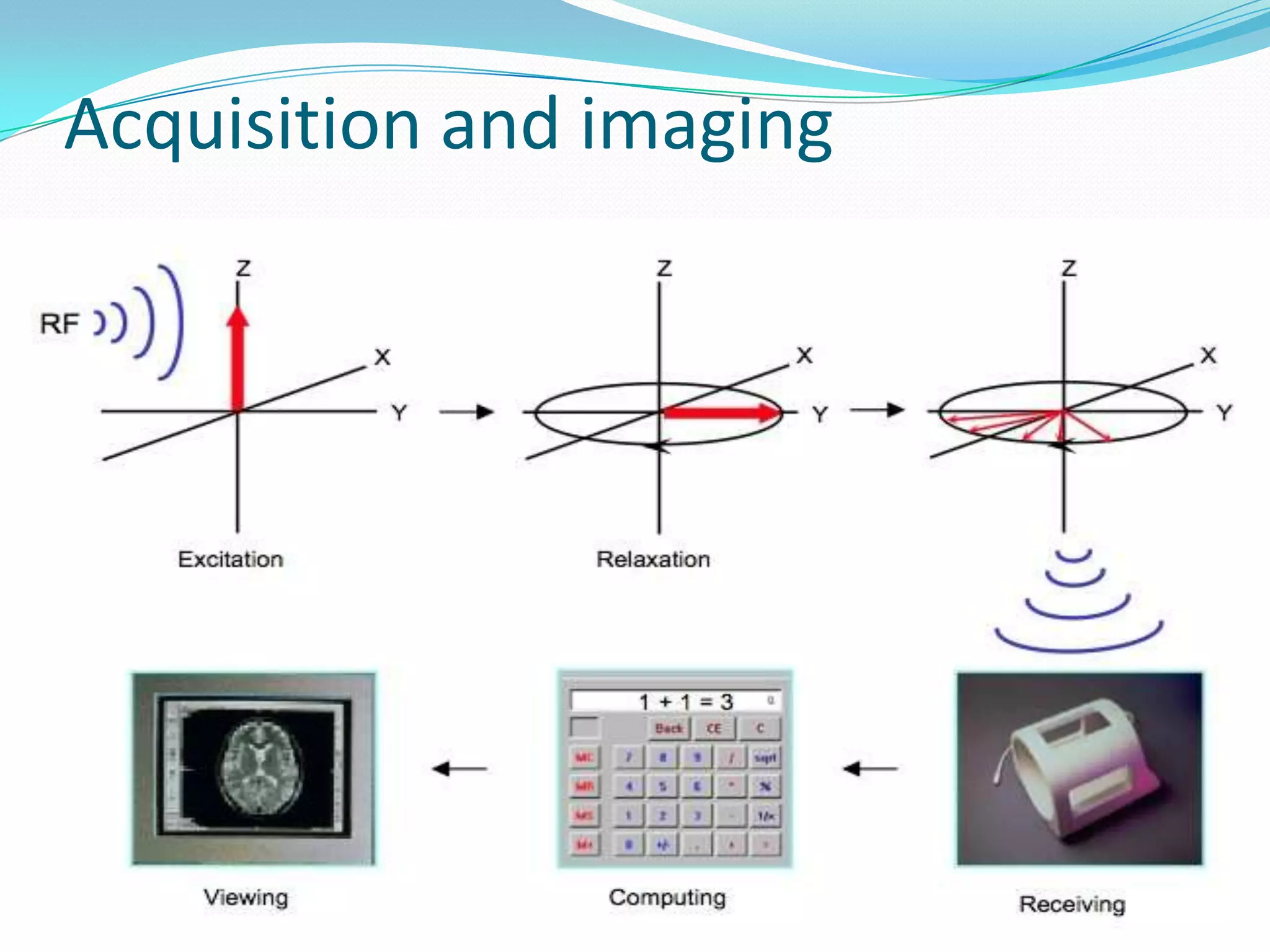 Mri for identifying types of fistulae | PPTX