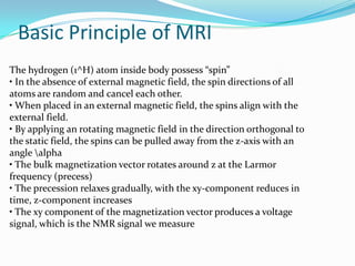 Mri for identifying types of fistulae | PPTX