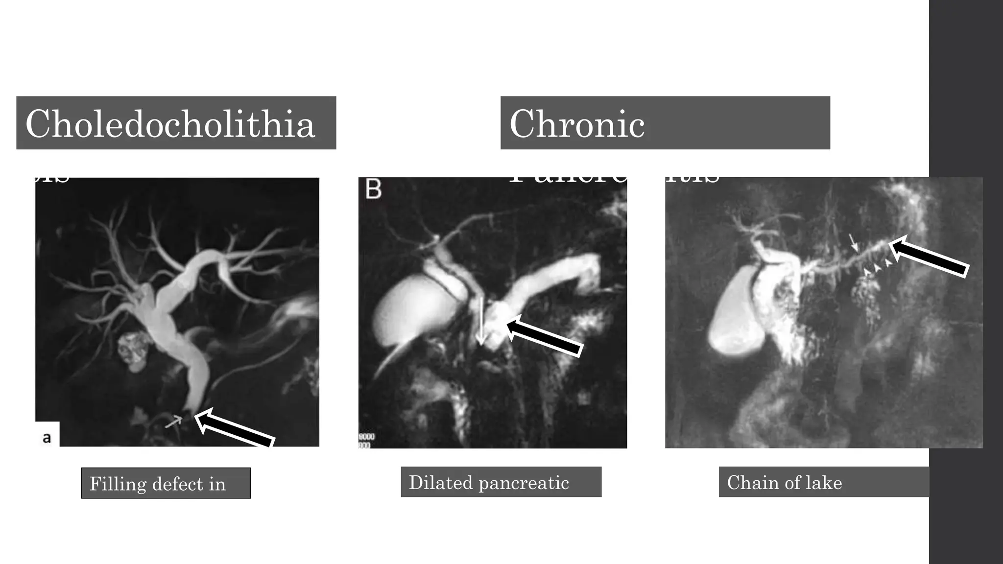 MRI for Surgeons introduction and basics | PPTX