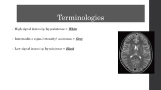 MRI for Surgeons introduction and basics | PPTX