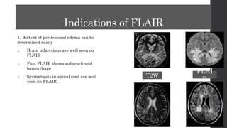 MRI for Surgeons introduction and basics | PPTX
