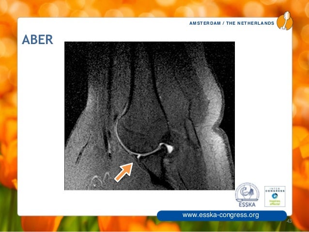 Shoulder MRI for Surgeons