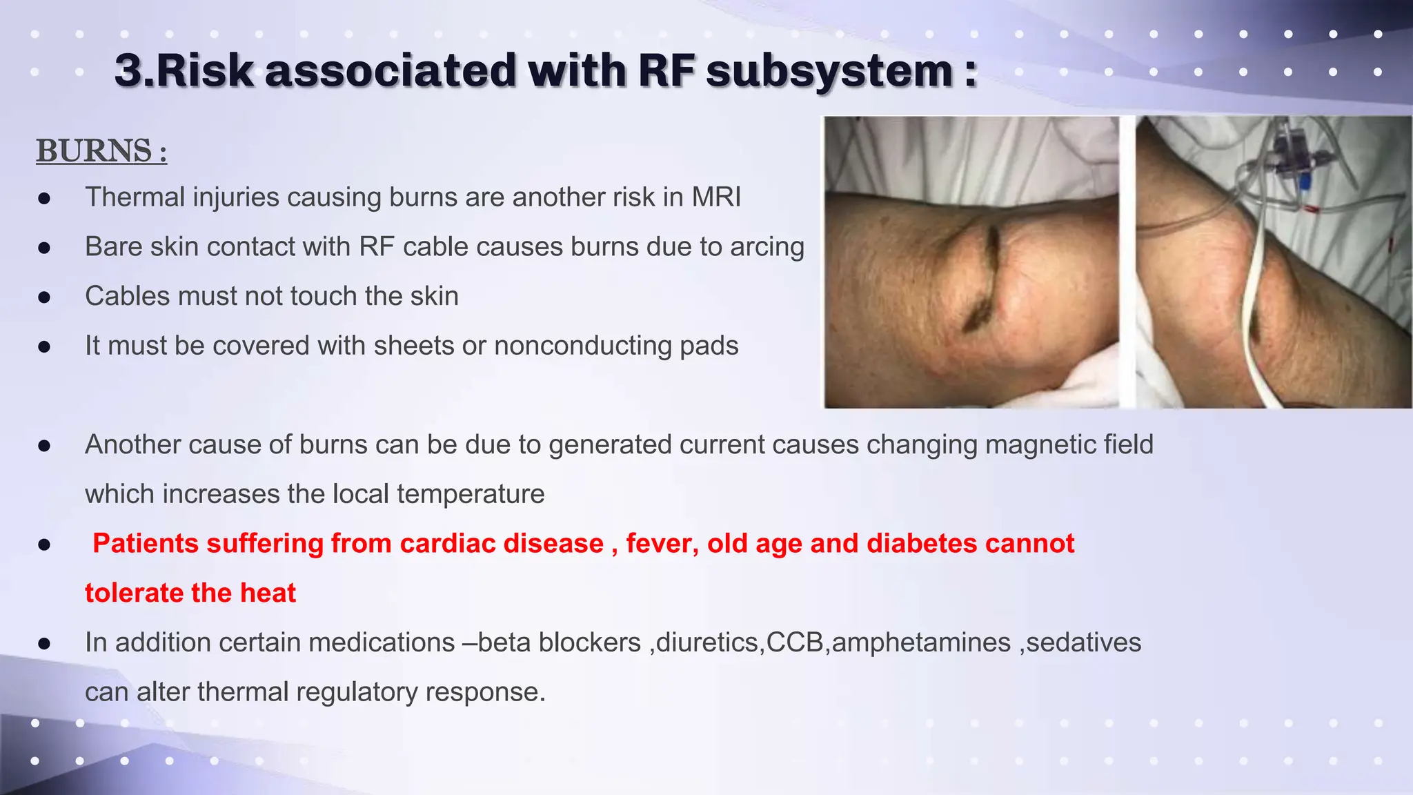 MRI HAZARDS mri mri mri mri mri mri mri mri | PPTX