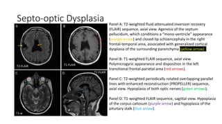 MRI HERE.pptx