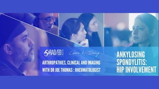 ANKYLOSING SPONDYLITIS PERIPHERAL JOINT HIP INVOLVEMENT RADEDASIA | PDF