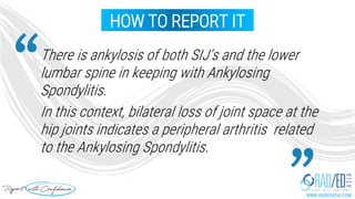 ANKYLOSING SPONDYLITIS PERIPHERAL JOINT HIP INVOLVEMENT RADEDASIA | PDF