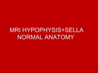 MRI HYPOPHYSIS+SELLA NORMAL ANATOMY Dr Ahmed Esawy | PPTX