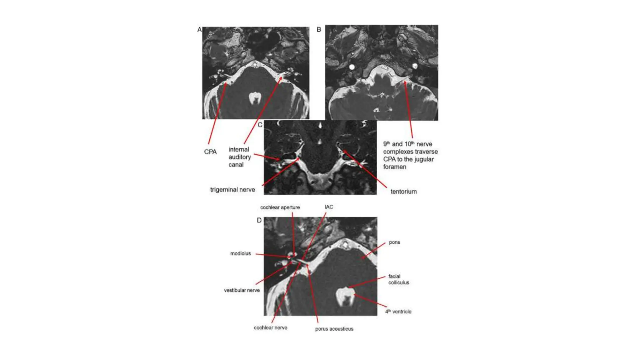MRI IAM.ppt abcdefghijklmnopqrstuvwxyz123 | PPT