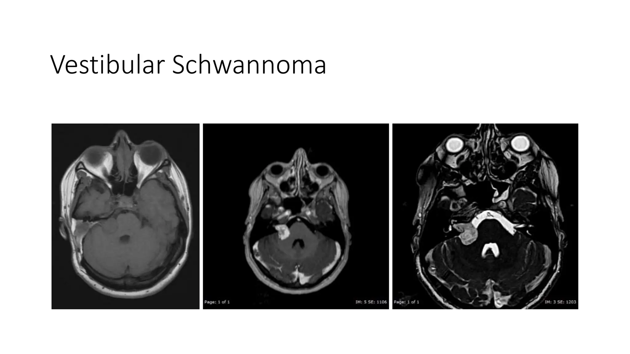 MRI IAM.ppt abcdefghijklmnopqrstuvwxyz123 | PPT