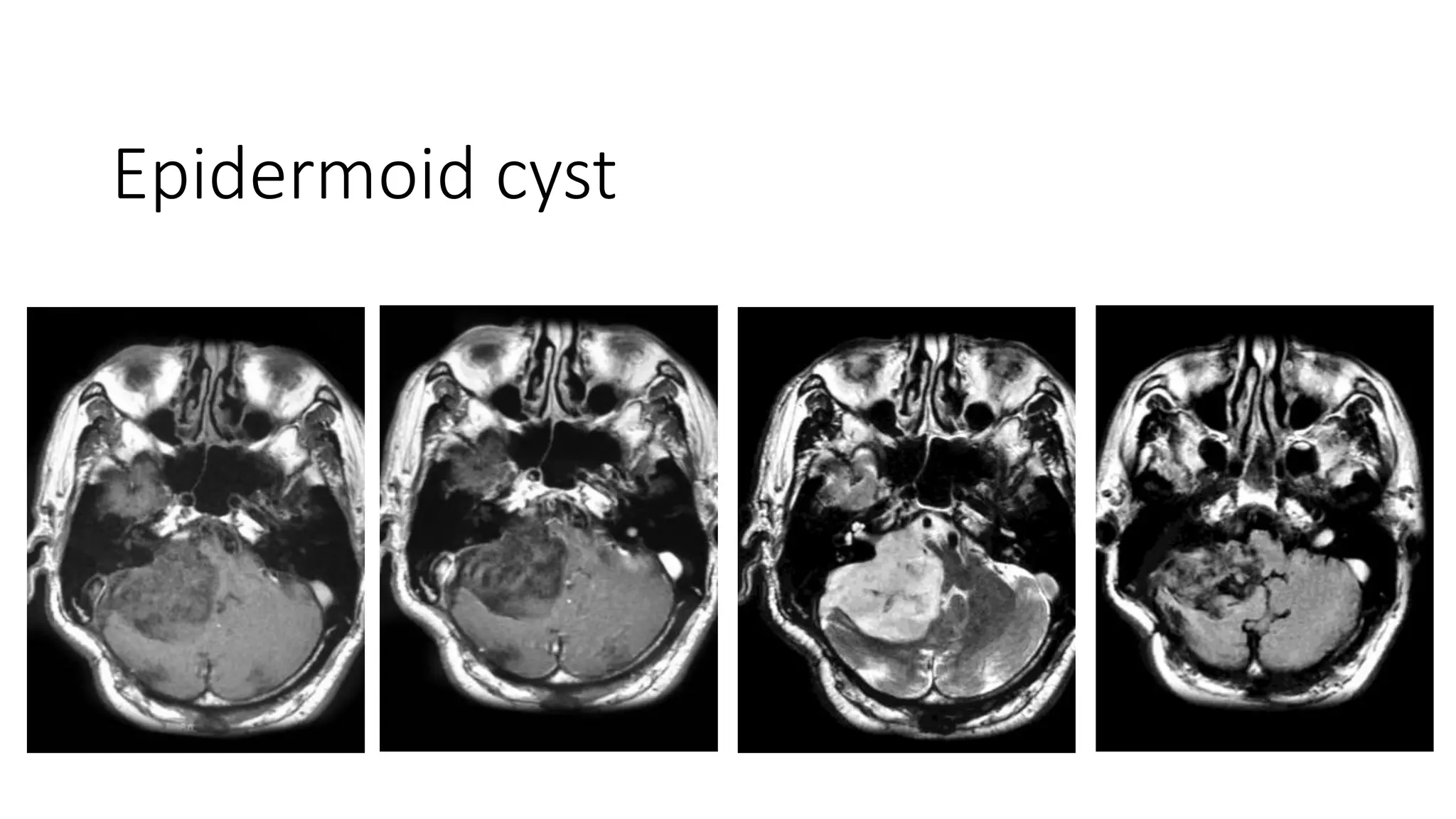MRI IAM.ppt abcdefghijklmnopqrstuvwxyz123 | PPT