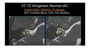 MRI IAM.ppt abcdefghijklmnopqrstuvwxyz123 | PPTX