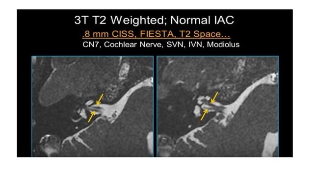 MRI IAM.ppt abcdefghijklmnopqrstuvwxyz123 | PPT