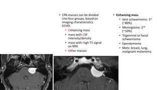MRI IAM.ppt abcdefghijklmnopqrstuvwxyz123 | PPT