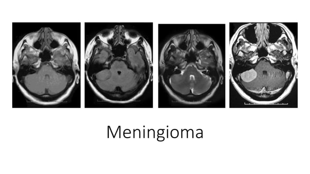 MRI IAM.ppt abcdefghijklmnopqrstuvwxyz123 | PPT