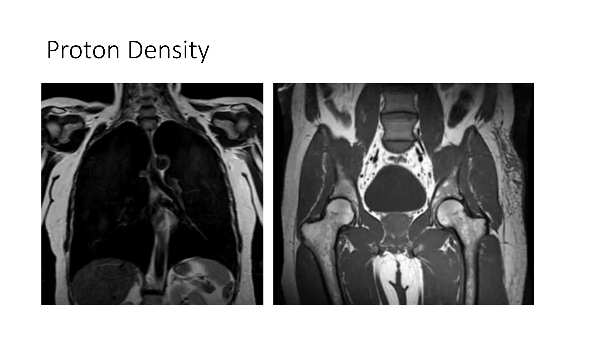 MRI IMAGE QUALITY and Factors affecting it by T.R.B. | PPTX