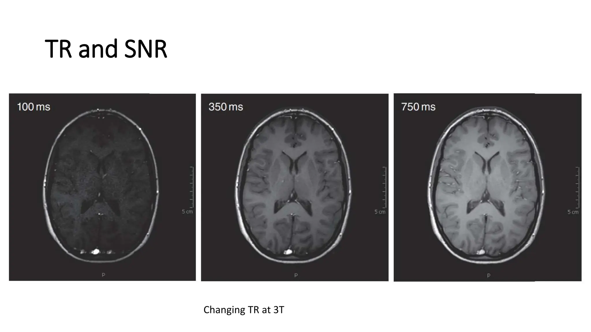 MRI IMAGE QUALITY and Factors affecting it by T.R.B. | PPTX | 3-D ...
