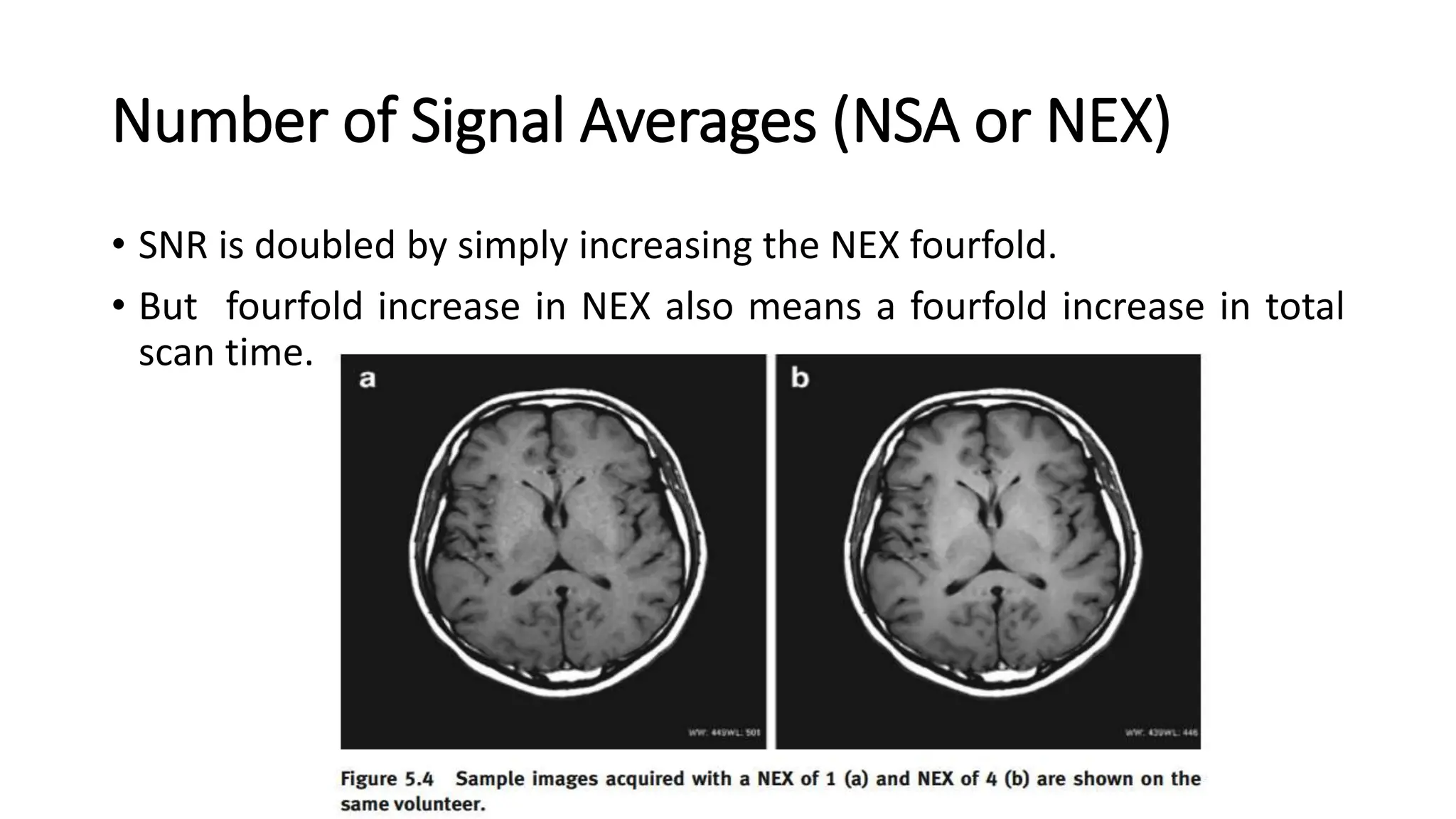 MRI IMAGE QUALITY and Factors affecting it by T.R.B. | PPTX