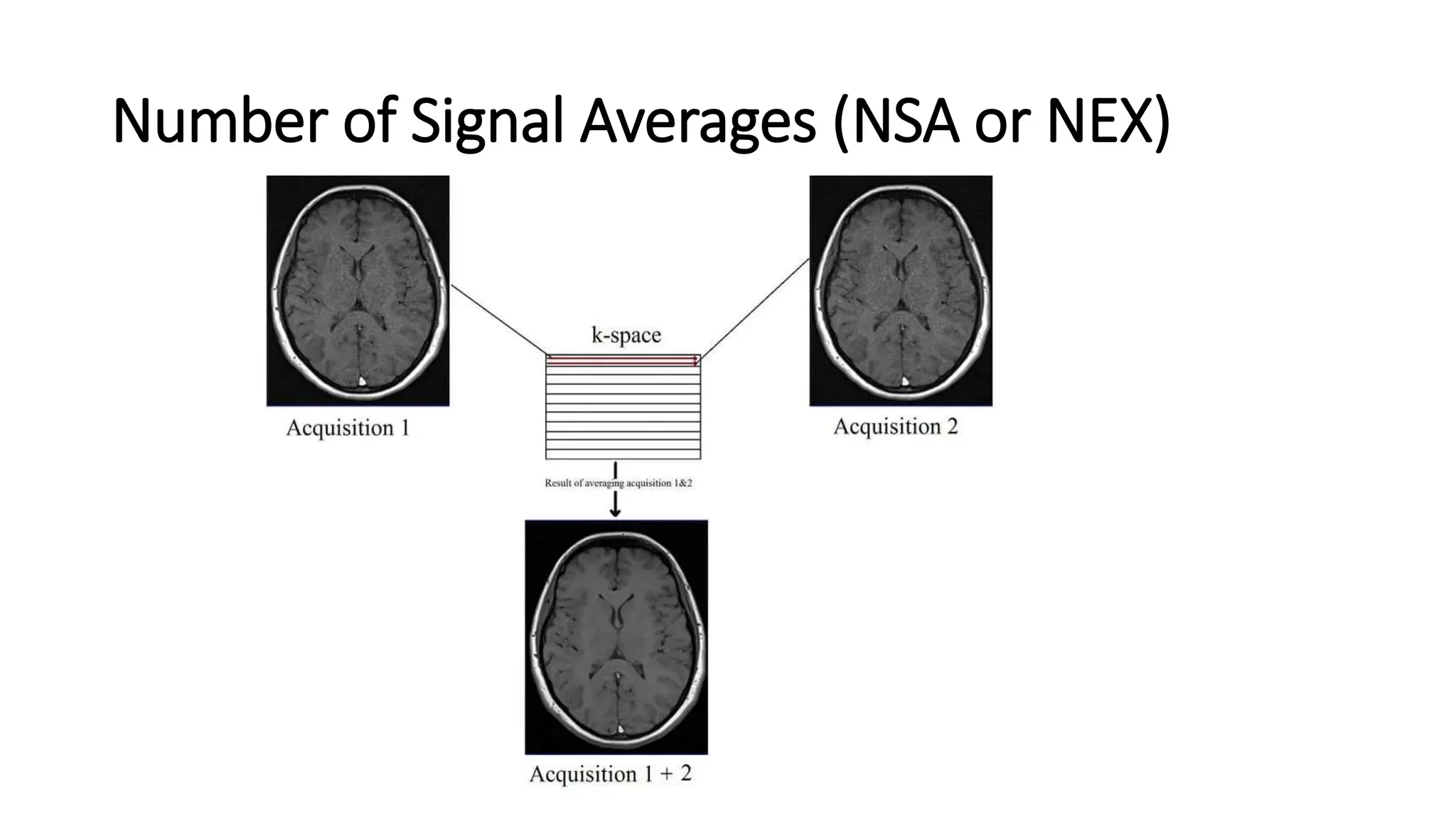MRI IMAGE QUALITY and Factors affecting it by T.R.B. | PPTX