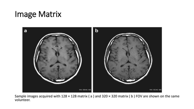 MRI IMAGE QUALITY and Factors affecting it by T.R.B. | PPTX | 3-D ...