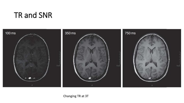 MRI IMAGE QUALITY and Factors affecting it by T.R.B. | PPTX | 3-D ...