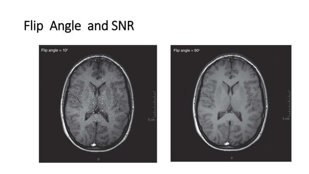 MRI IMAGE QUALITY and Factors affecting it by T.R.B. | PPTX | 3-D ...