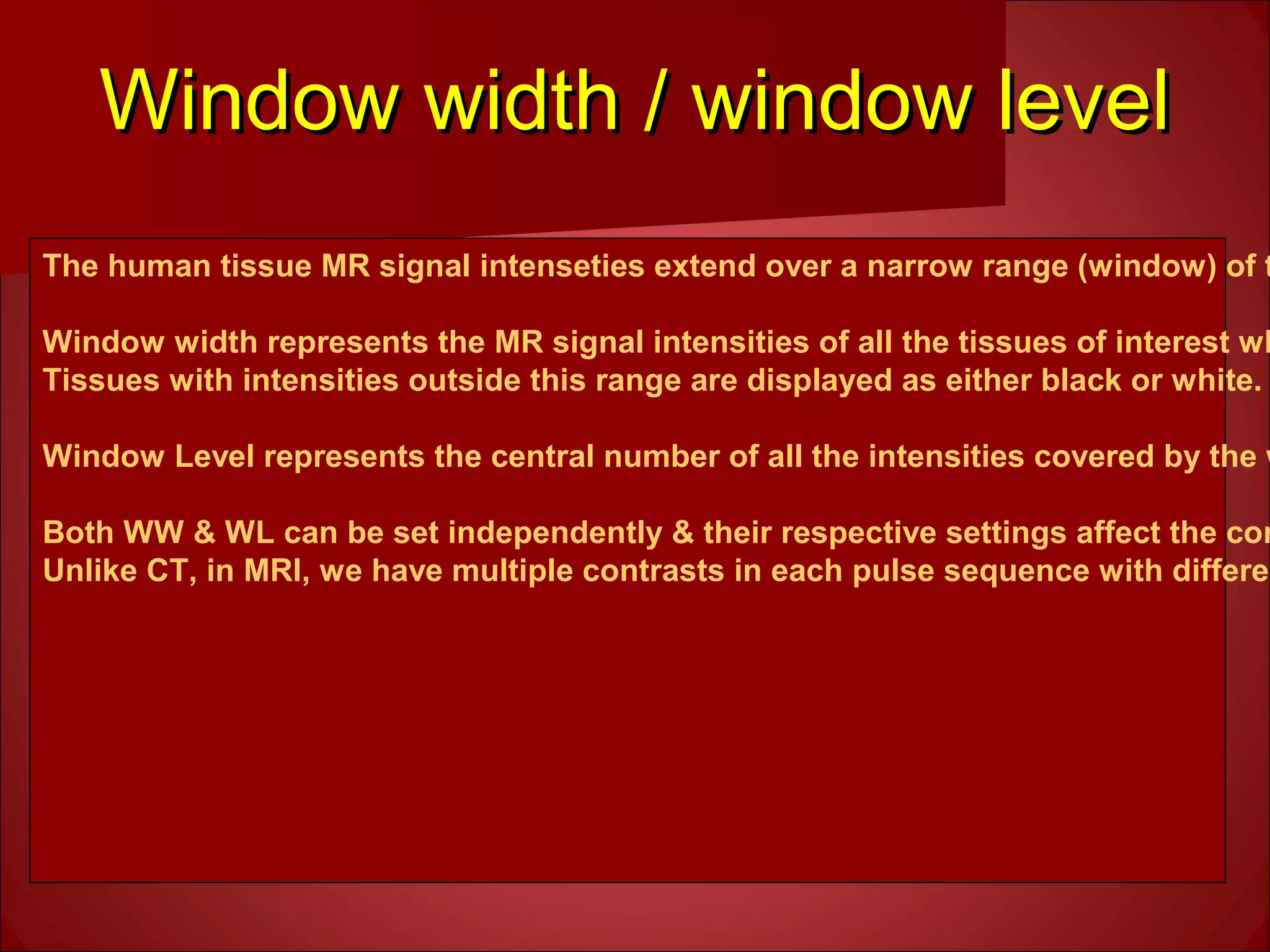 Mri image quality gamal mahdaly | PPT