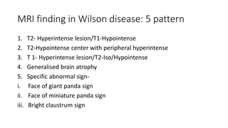 Mri imaging finding in wilson disease | PPTX