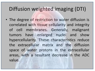 MRI imaging of brain tumors. A practical approach. | PPTX