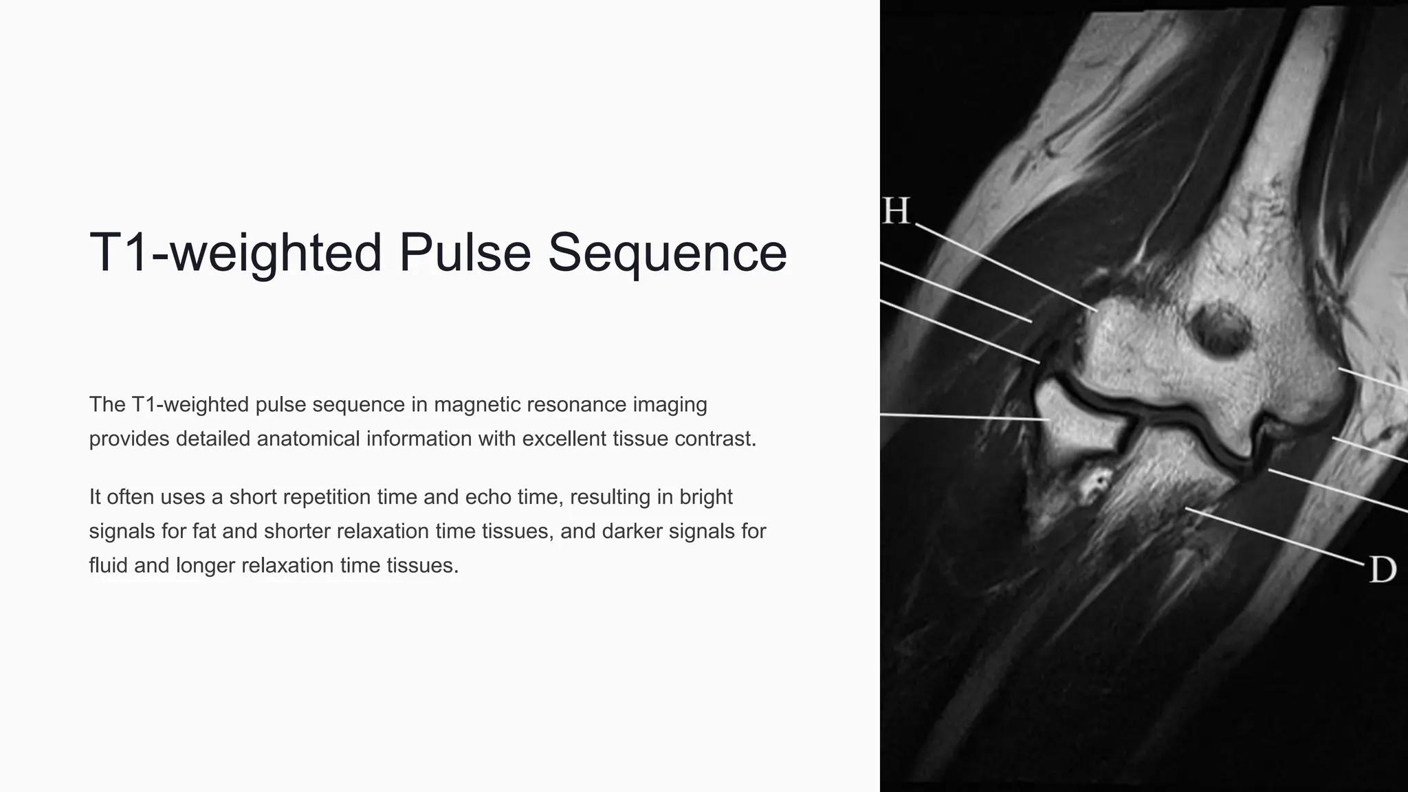 Magnetic Resonance imaging sequence.pptx