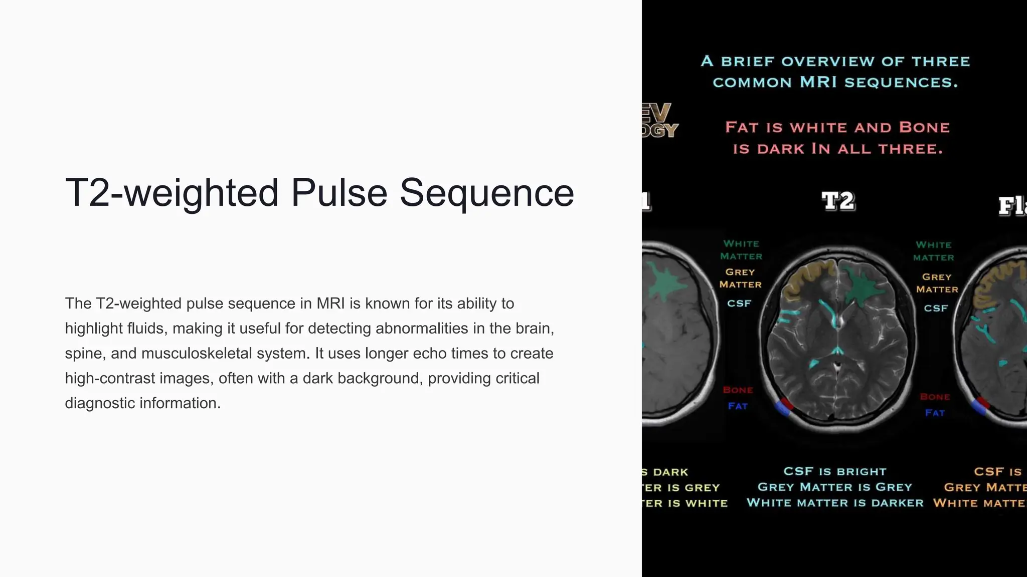 Magnetic Resonance imaging sequence.pptx