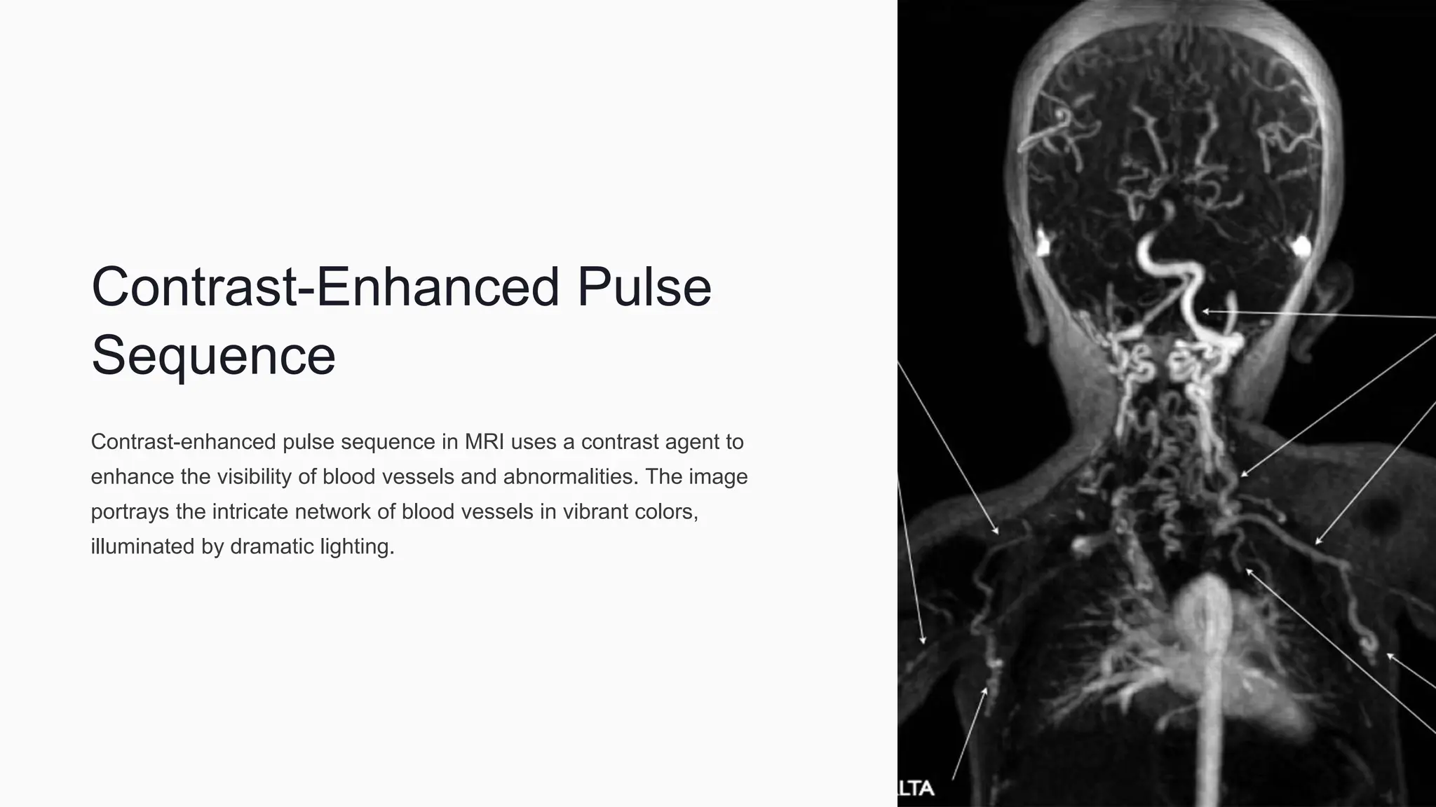 Magnetic Resonance imaging sequence.pptx