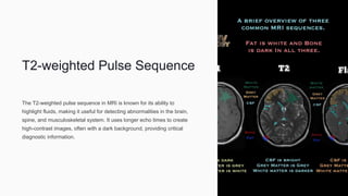 Magnetic Resonance imaging sequence.pptx