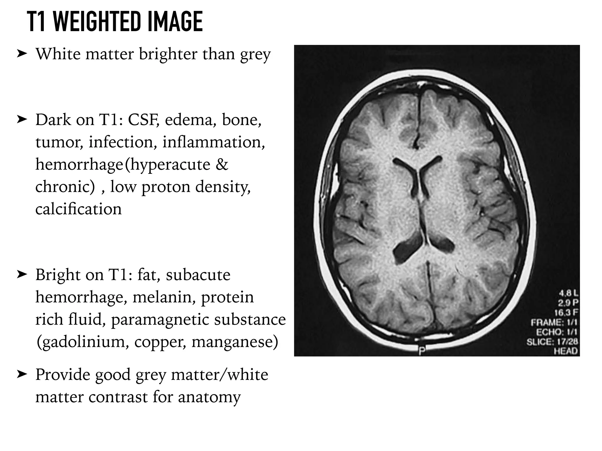 Mri in children | PDF
