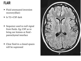 Mri in children | PDF