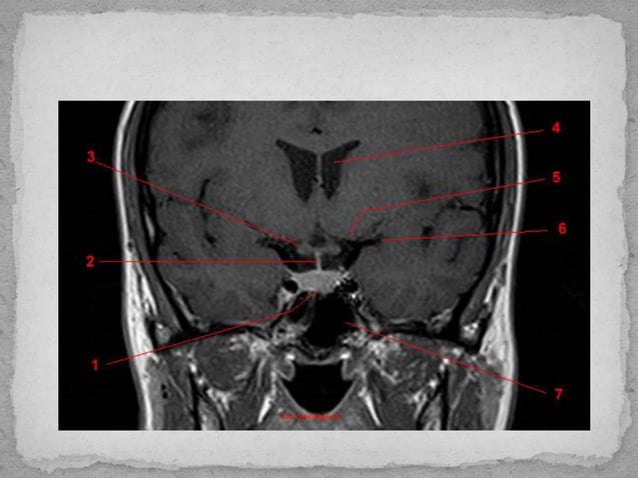 Mri in ent | PPTX | Chemistry | Science