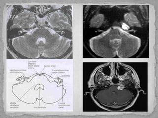 Mri in ent | PPTX