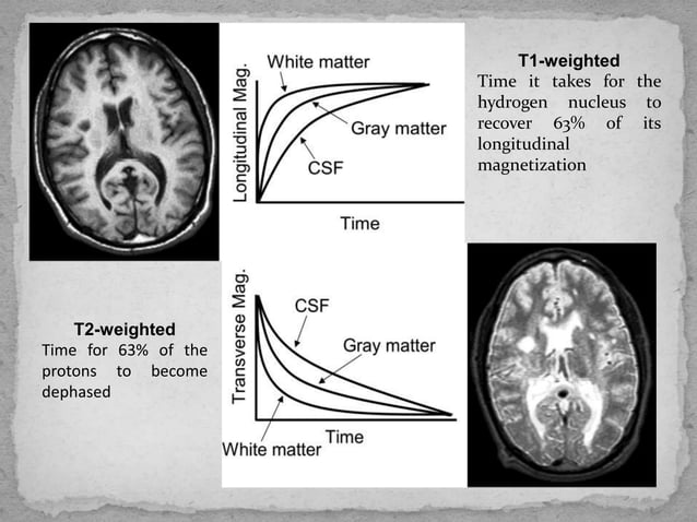 Mri in ent | PPTX | Chemistry | Science