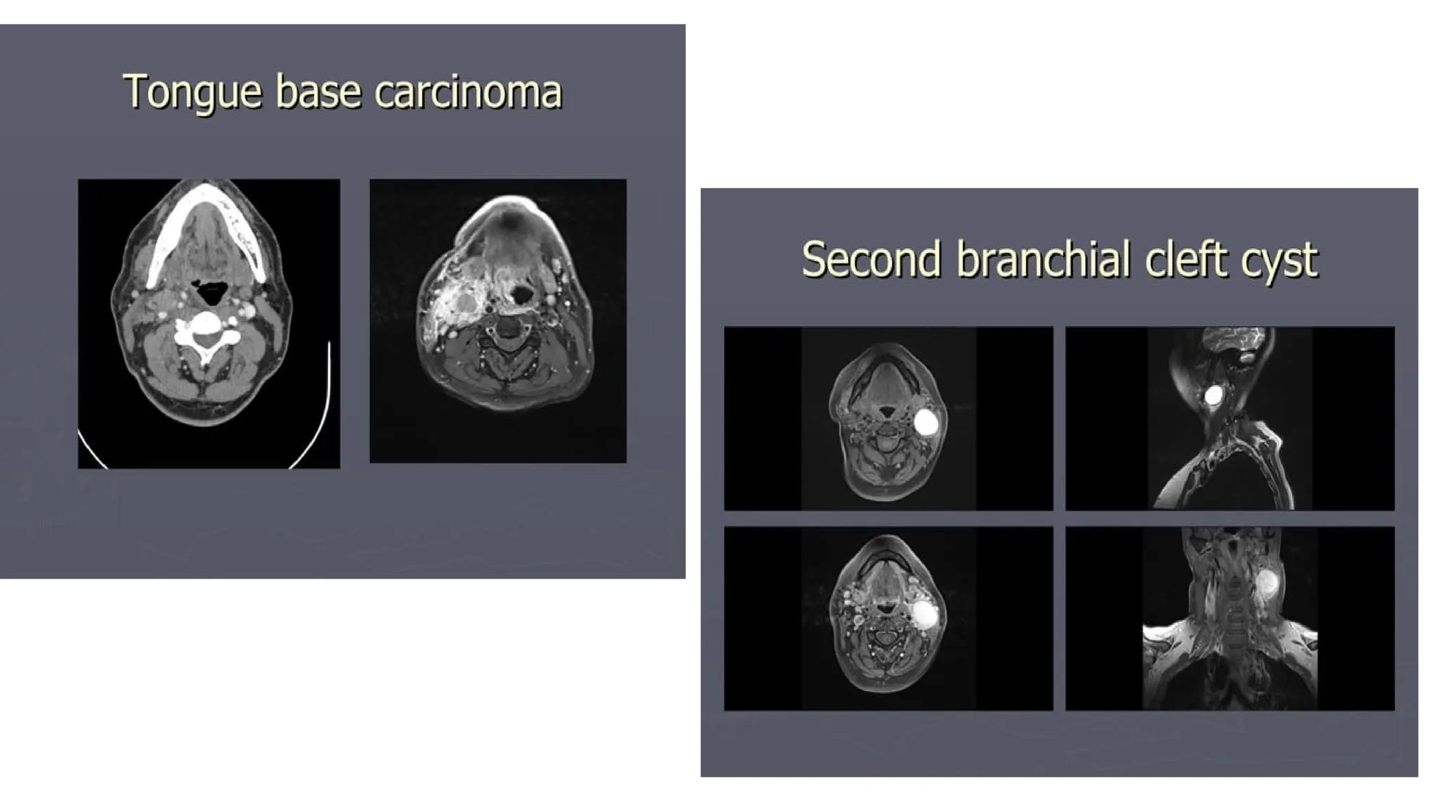 mri in ent final for learning purpose.pptx