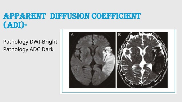 mri in ent final for learning purpose.pptx | Medical Tests | Medical Health