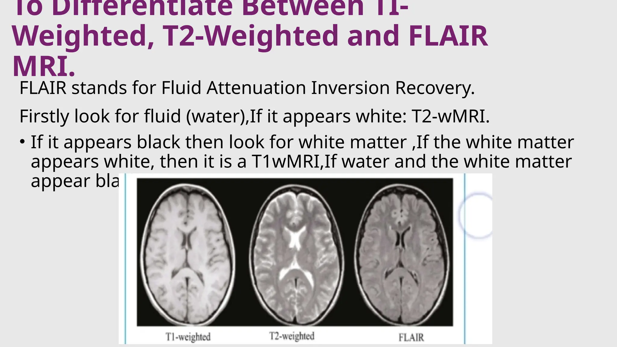 mri in ent final nejshdifndhsjjsbdhxhcopy.pptx